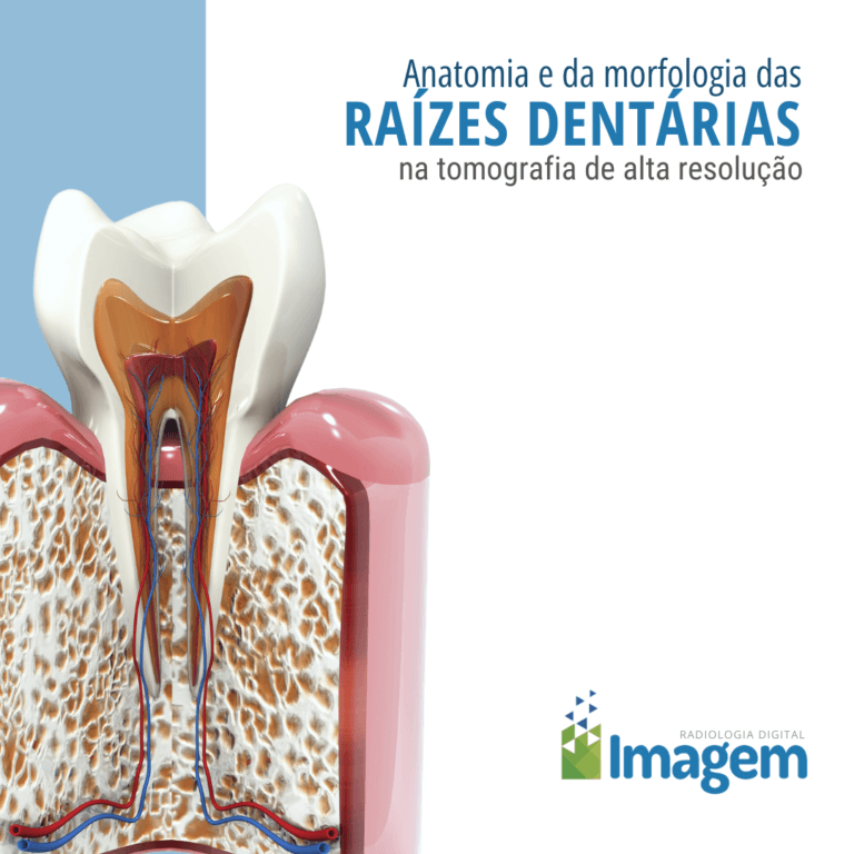 Anatomia e Morfologia das Raízes Dentárias – Imagem Radiologia
